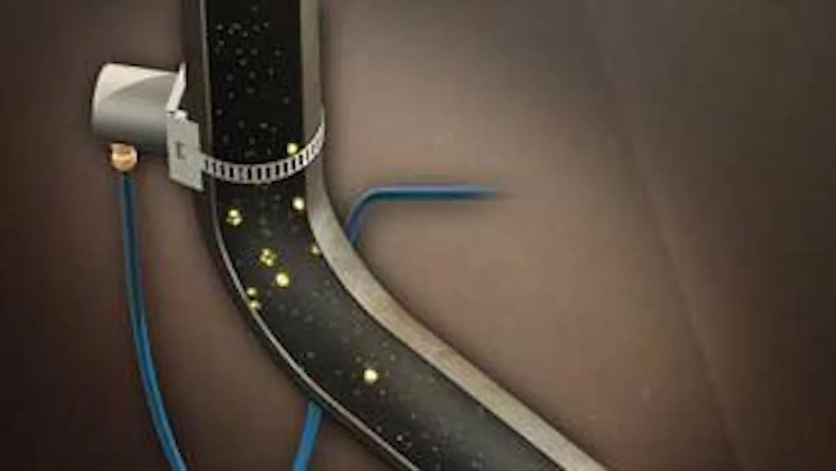 Managing sand and erosive solids to optimize safety and production ...
